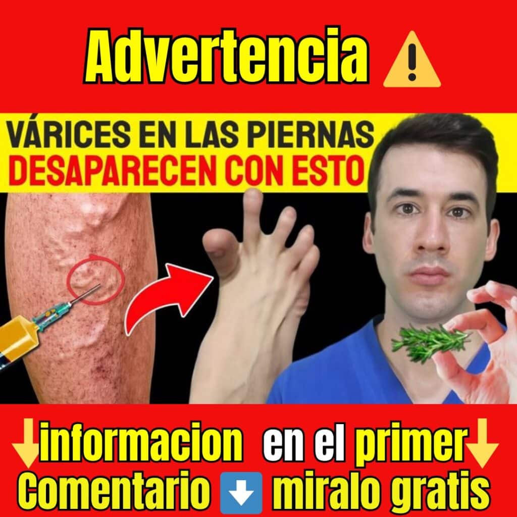 ¡Cura las várices en las piernas con este secreto! – Mejora la ...